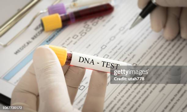 How Accurate is a DNA Test for Paternity? An Expert's Insight