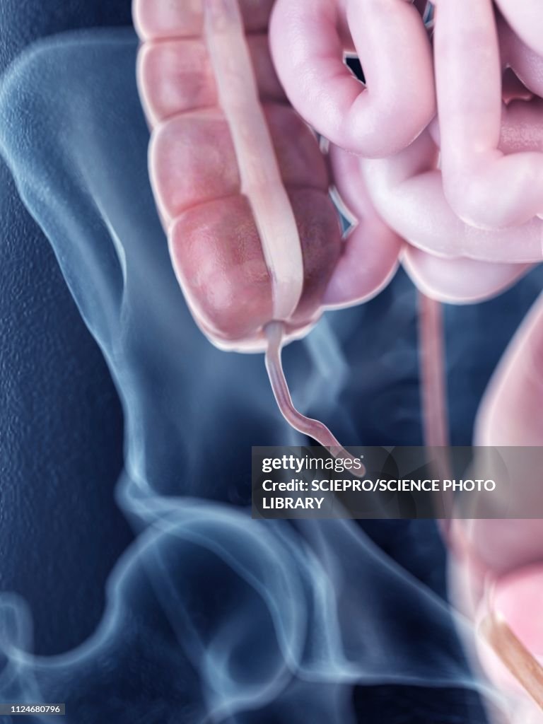Illustration Of The Human Appendix Anatomy High-Res Vector Graphic ... Illustration Of The Human Appendix Anatomy High-Res Vector Graphic ...