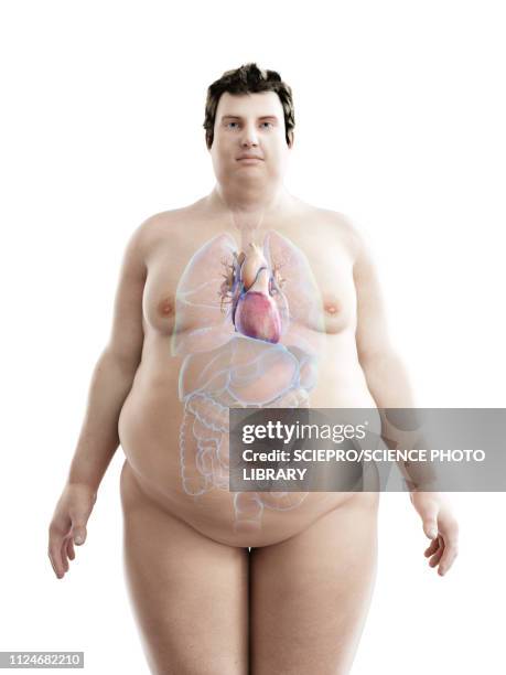 146 Obesity Heart High Res Illustrations - Getty Images 146 Obesity Heart High Res Illustrations - Getty Images