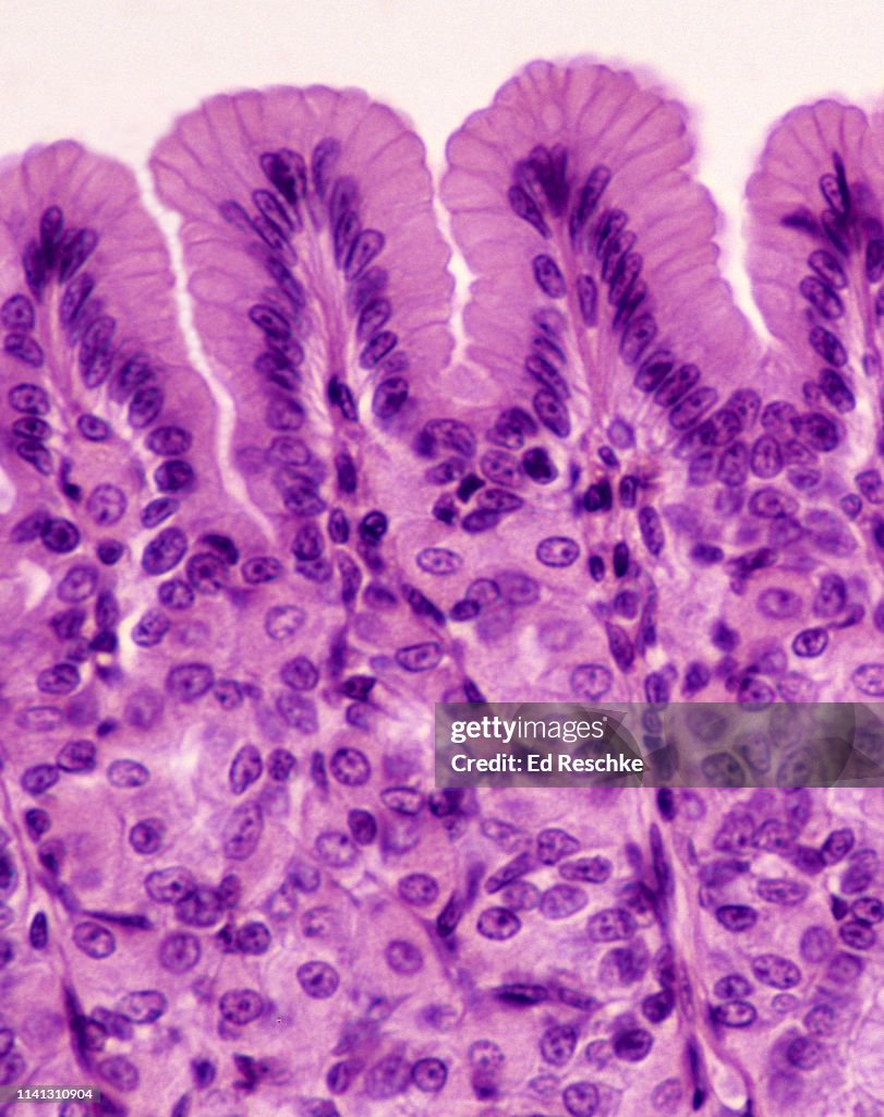 Simple Columnar Epithelium 100x