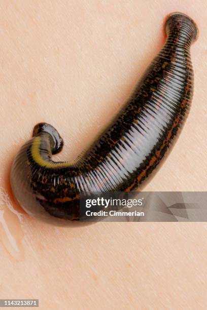 Medicinal leech on a skin (1143213871) - 게티이미지뱅크