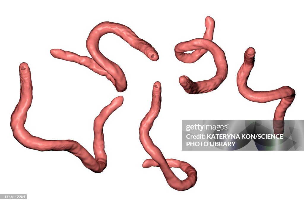 Ancylostoma Hookworm Illustration High Res Vector Graphic Getty Images