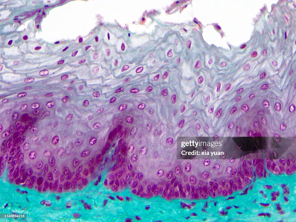Stratified Squamous Epithelium Slide Labeled Stratified Squamous Epithelium Slide Labeled