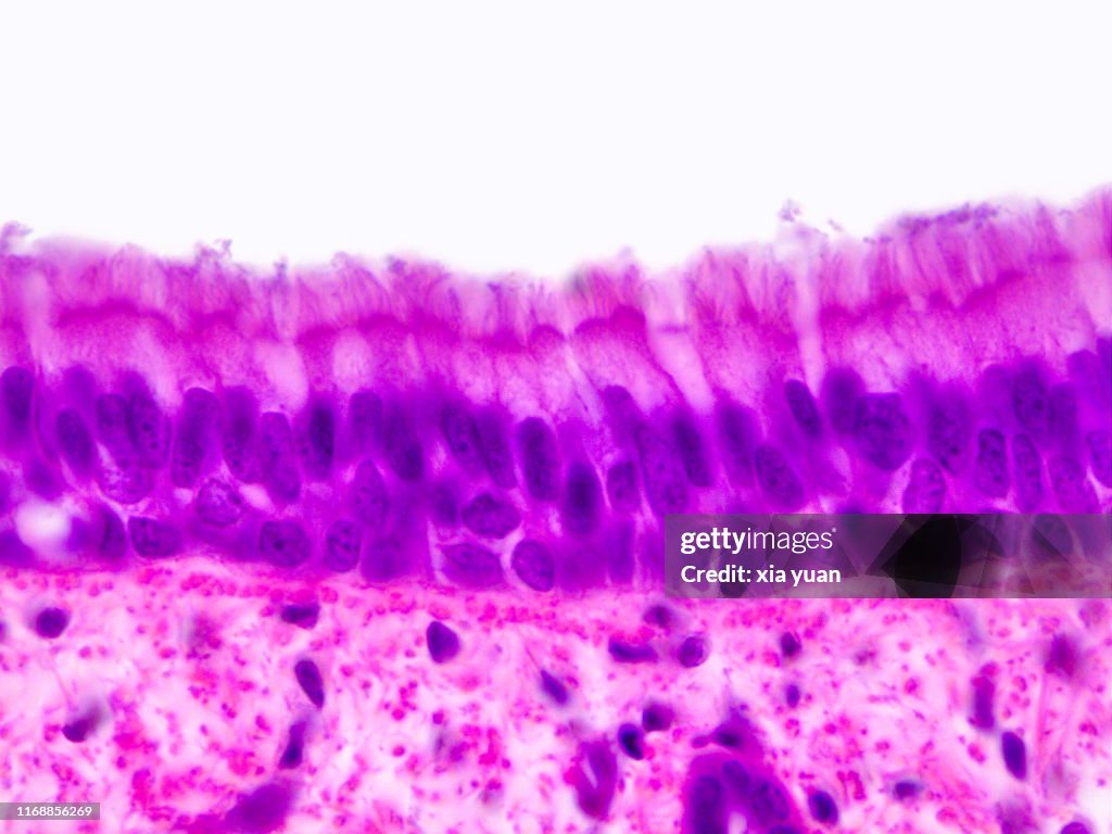 Simple Ciliated Columnar Epithelium Simple Ciliated Columnar Epithelium