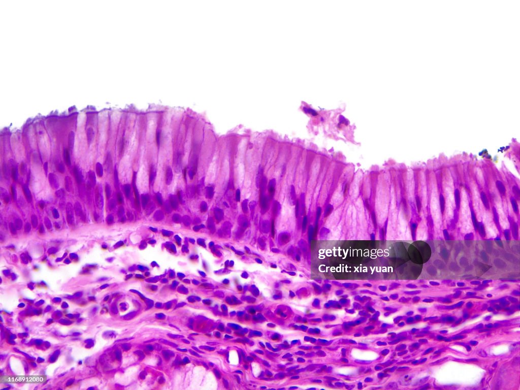 Pseudostratified Ciliated Columnar Epithelium Solved (a) Survey Pseudostratified Ciliated Columnar Epithelium Solved (a) Survey
