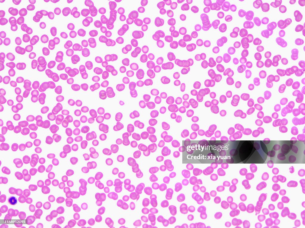 Red Blood Cells 40x Light Micrograph High-Res Stock Photo - Getty Images Red Blood Cells 40x Light Micrograph High-Res Stock Photo - Getty Images