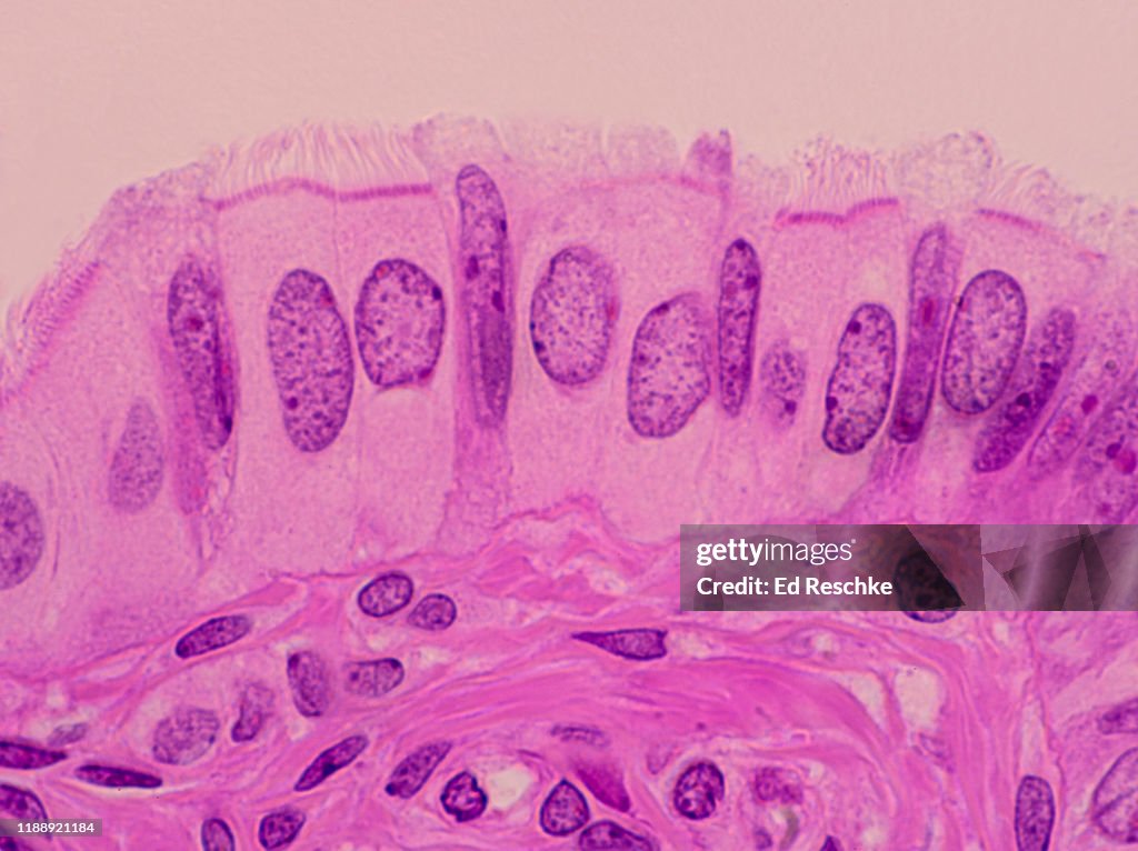 Simple Ciliated Columnar Epithelium Simple Ciliated Columnar Epithelium