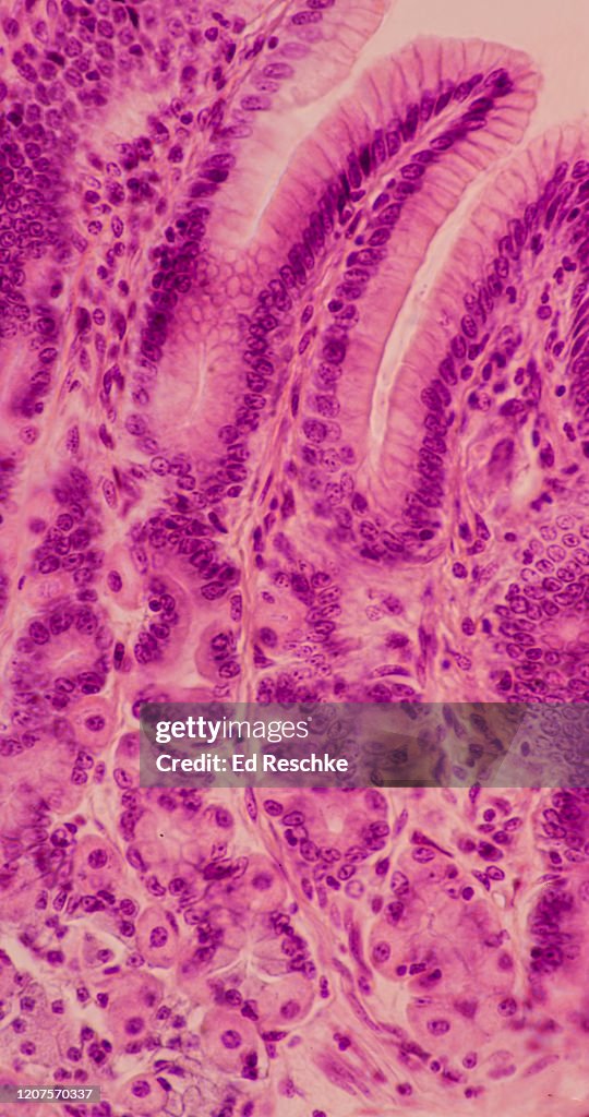 Stomach Histology Labeled Chief Cells