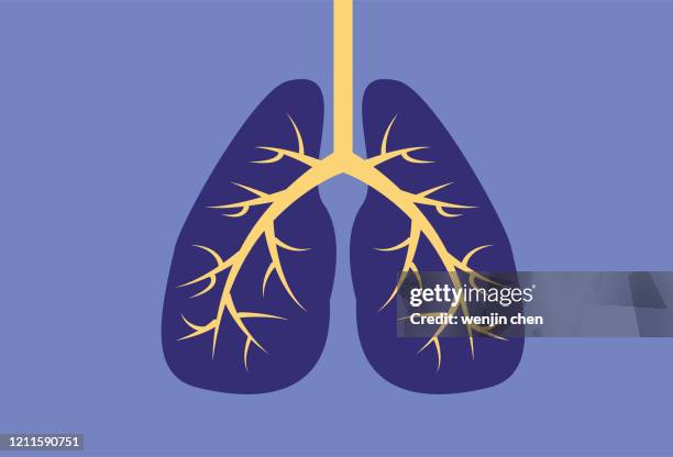 Lung Ct Scan High Res Illustrations - Getty Images Lung Ct Scan High Res Illustrations - Getty Images