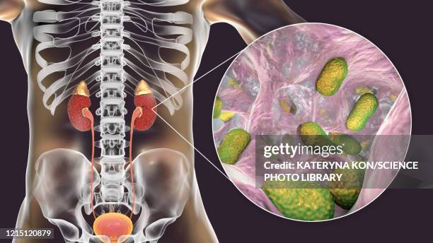 55 Acinetobacter Stock Photos, High-Res Pictures, and Images - Getty Images 55 Acinetobacter Stock Photos, High-Res Pictures, and Images - Getty Images