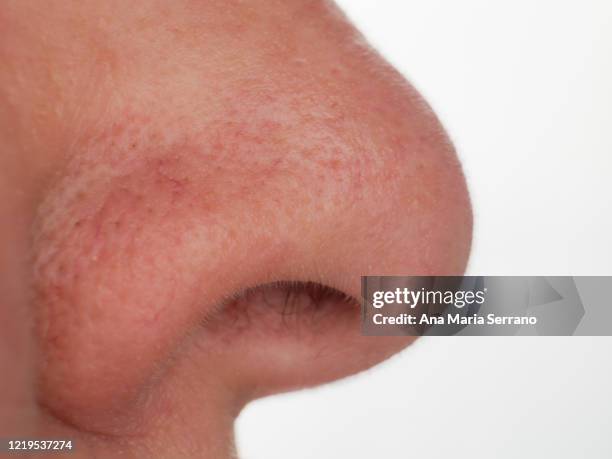 Human Nose Close Up Human Nose Close Up