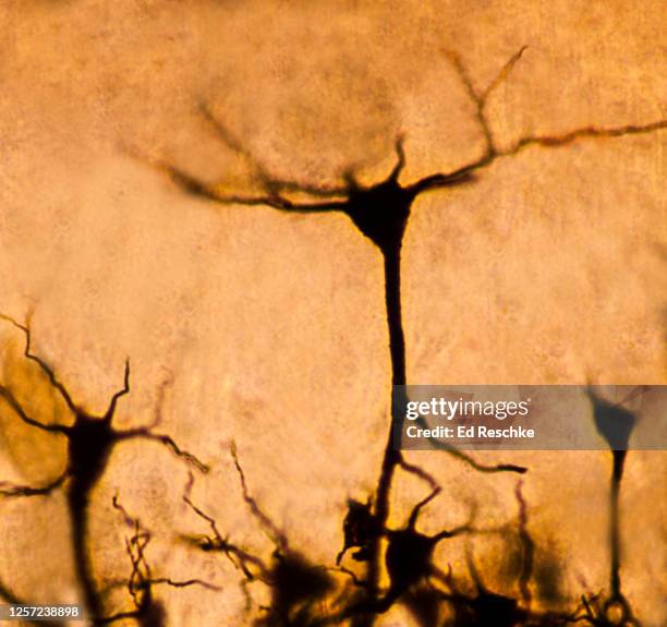Neuronas Multipolares Fotografías E Imágenes De Stock Getty Images