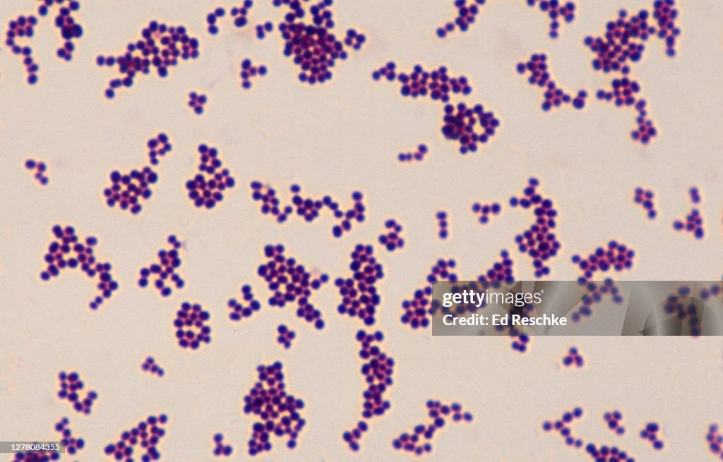 Staphylococcus Aureus Gram Stain