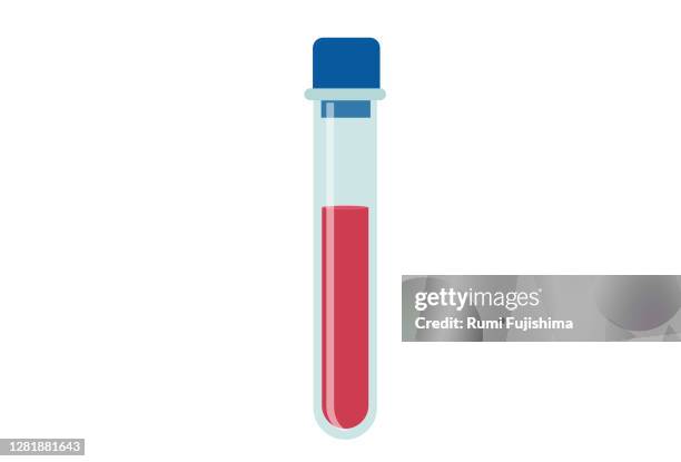 Measuring Flask Photos and Premium High Res Pictures - Getty Images Measuring Flask Photos and Premium High Res Pictures - Getty Images