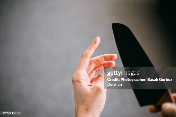 Cut Finger Cooking Photos And Premium High Res Pictures Getty Images