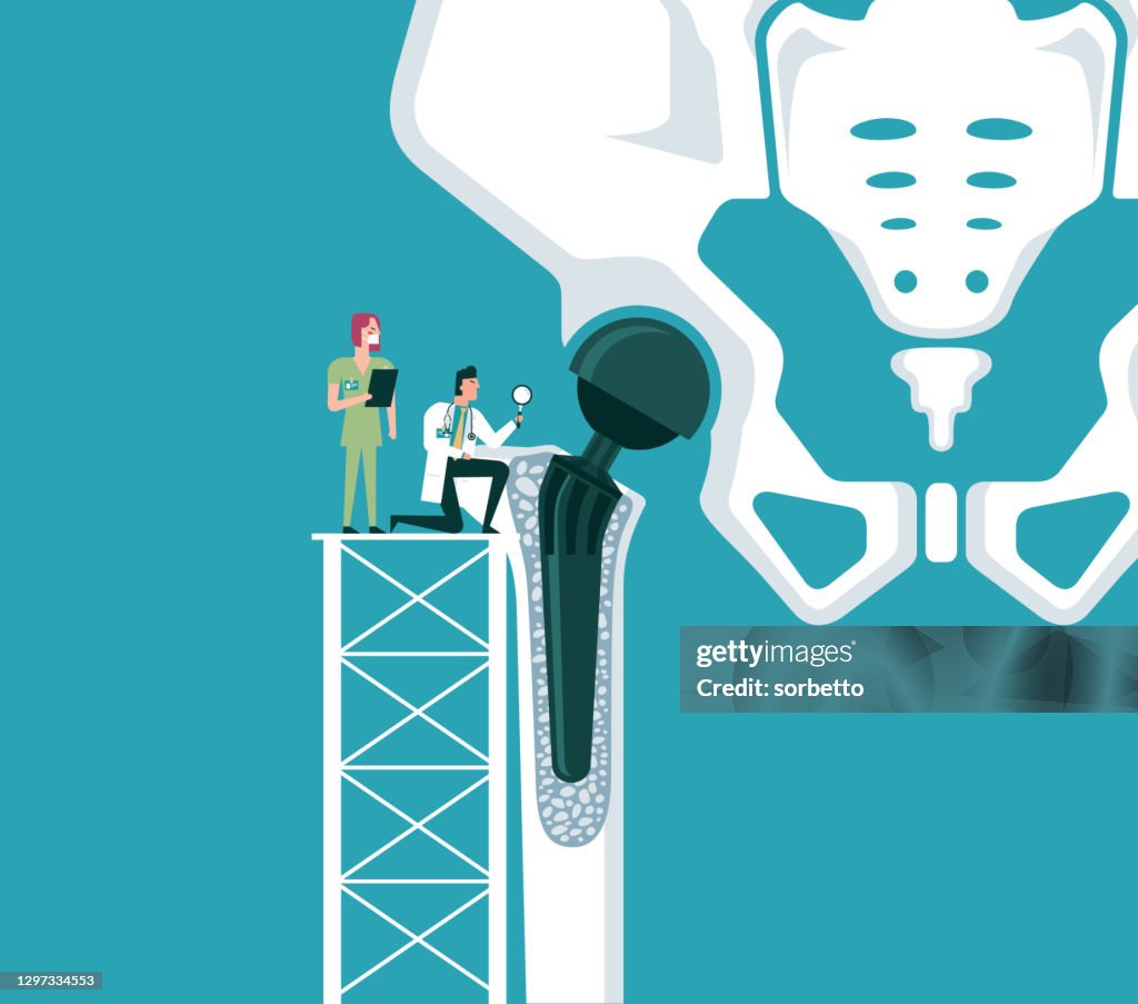 Structure Of The Artificial Hip Joint High Res Vector Graphic Getty Images