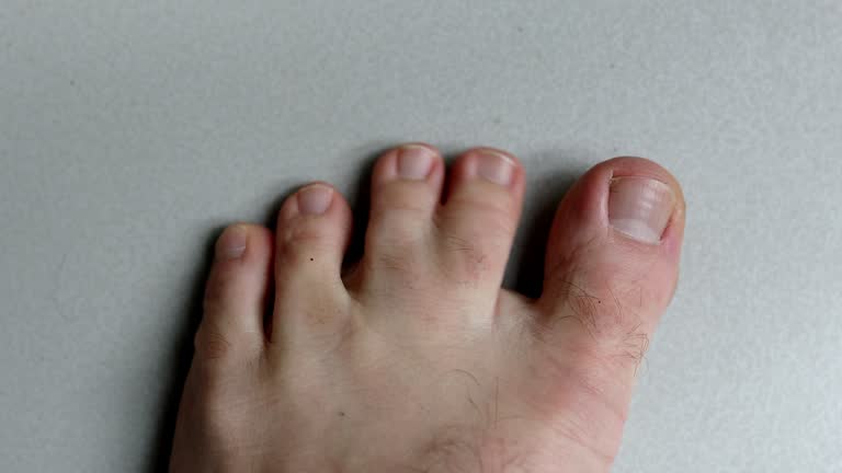 32 Wiggling Toes Stock Videos Footage And 4k Video Clips Getty Images