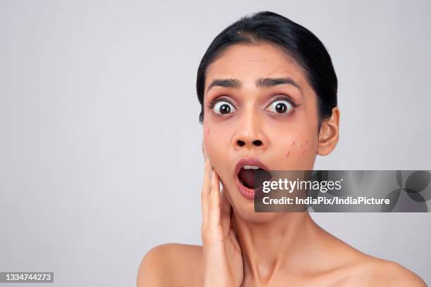 Indian Woman Acne Photos And Premium High Res Pictures Getty Images