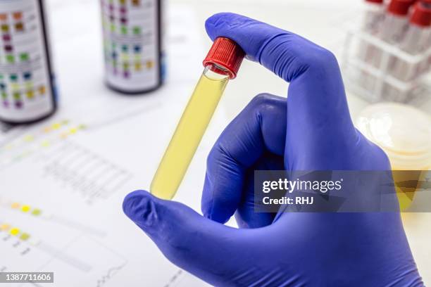 Why Regular Drug Testing is Essential for Workplace Safety in Charlotte