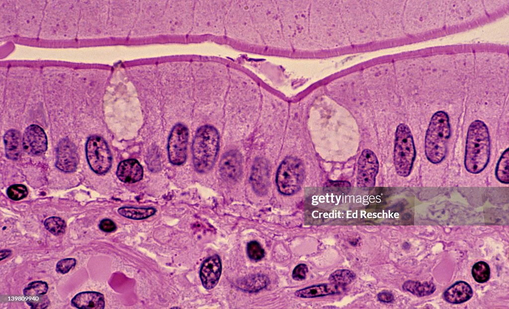 Simple Columnar Epithelium Under Microscope Simple Columnar Epithelium Under Microscope