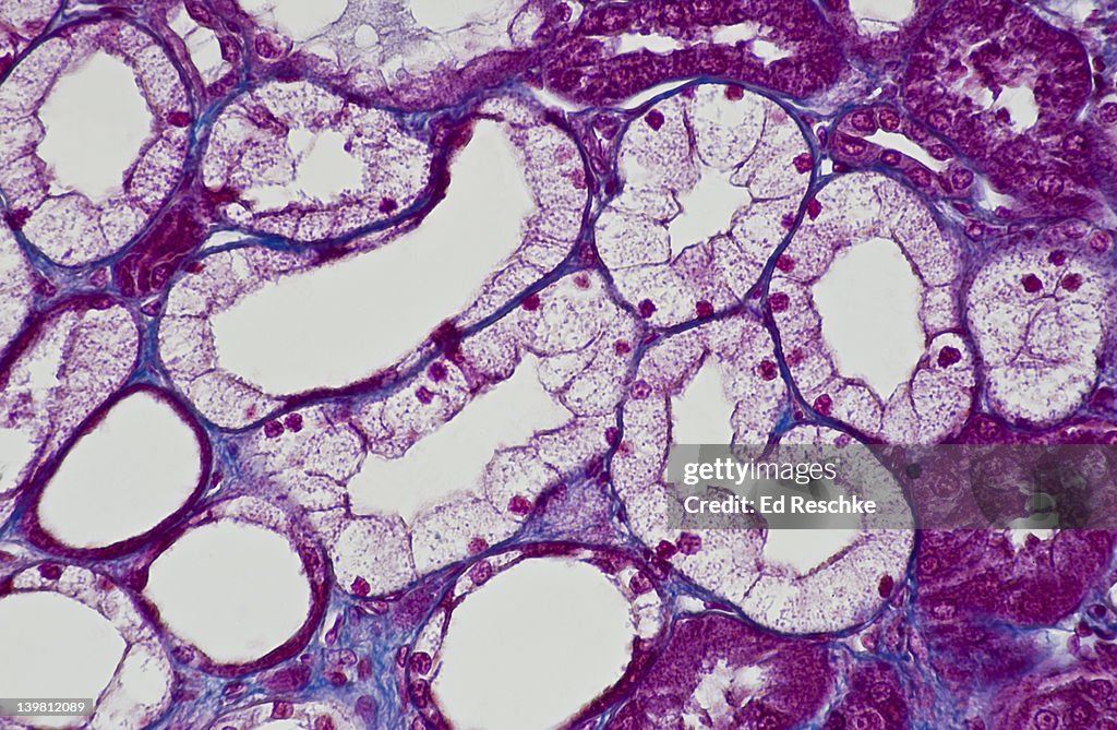 Simple Cuboidal Epithelium Kidney Labeled Simple Cuboidal Epithelium Kidney Labeled
