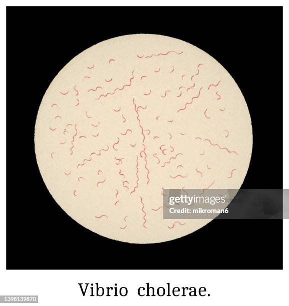 Vibrio Cholerae Gram Stain