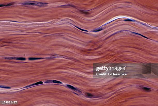 Dense Regular Connective Tissue Stock-Fotos und Bilder - Getty Images Dense Regular Connective Tissue Stock-Fotos und Bilder - Getty Images