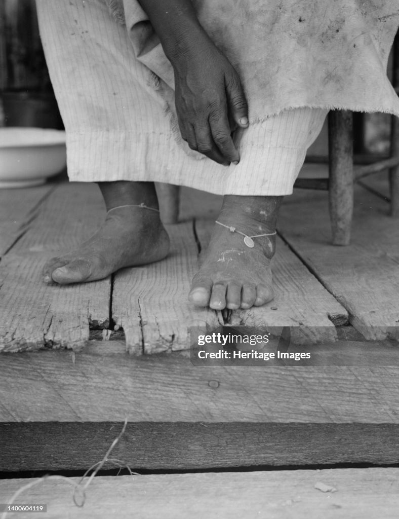 Fifty Seven Year Old Sharecropper Woman Hinds County Mississippi