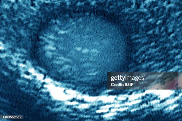 Testicular Ultrasound Photos And Premium High Res Pictures Getty Images