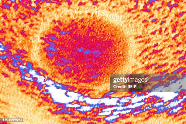 Testicular Ultrasound Photos And Premium High Res Pictures Getty Images