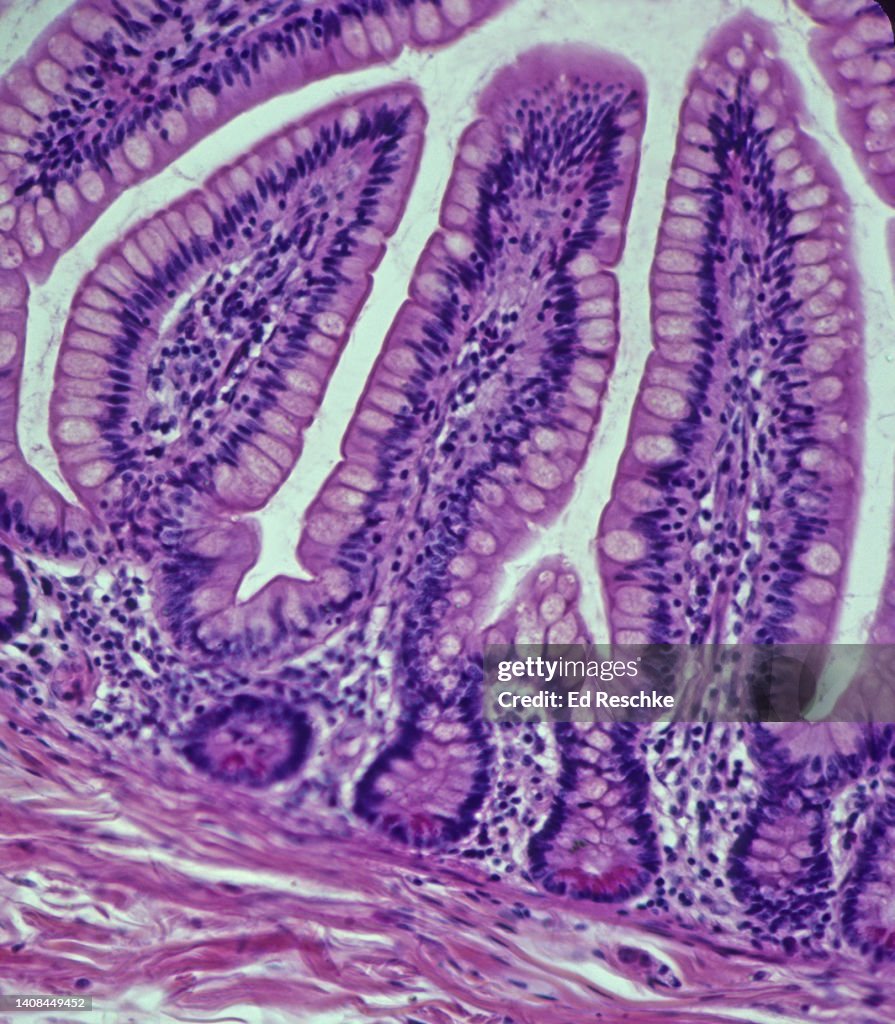 Simple Columnar Epithelium Small Intestine