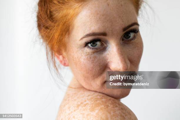 Redhead Facials Photos And Premium High Res Pictures Getty Images