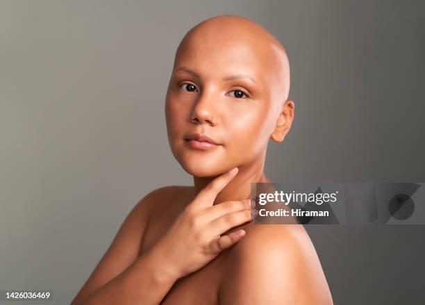 Alopecia Black Woman Photos And Premium High Res Pictures Getty Images