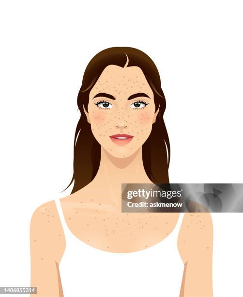 Skin Close Up Freckles High Res Illustrations Getty Images