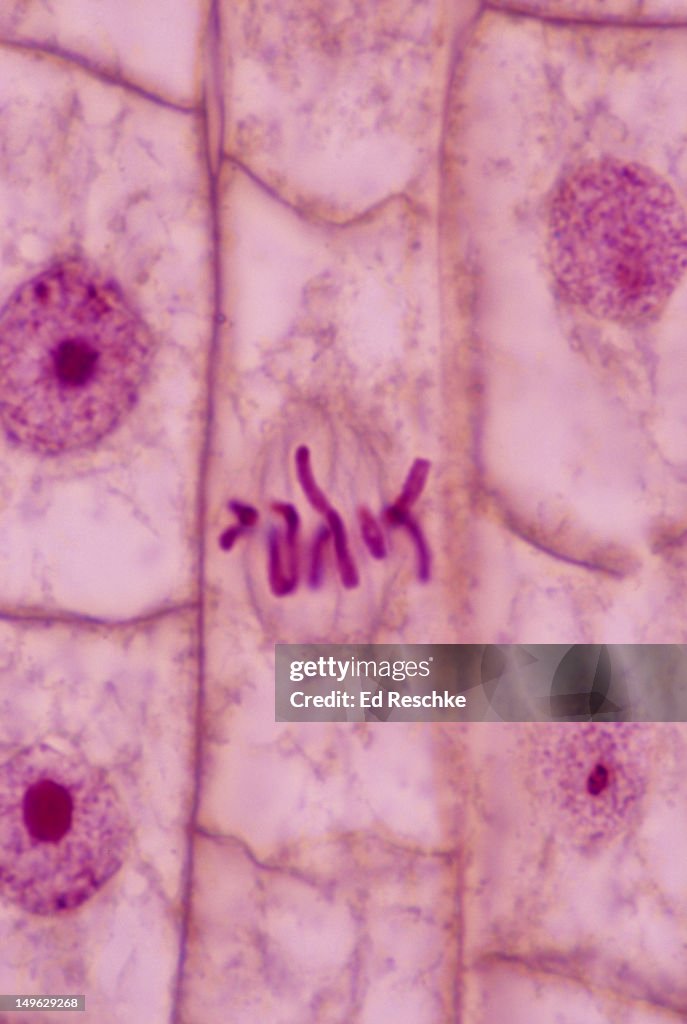 Metaphase Plant Mitois Onion Root Tip 400x High-Res Stock Photo - Getty ... Metaphase Plant Mitois Onion Root Tip 400x High-Res Stock Photo - Getty ...