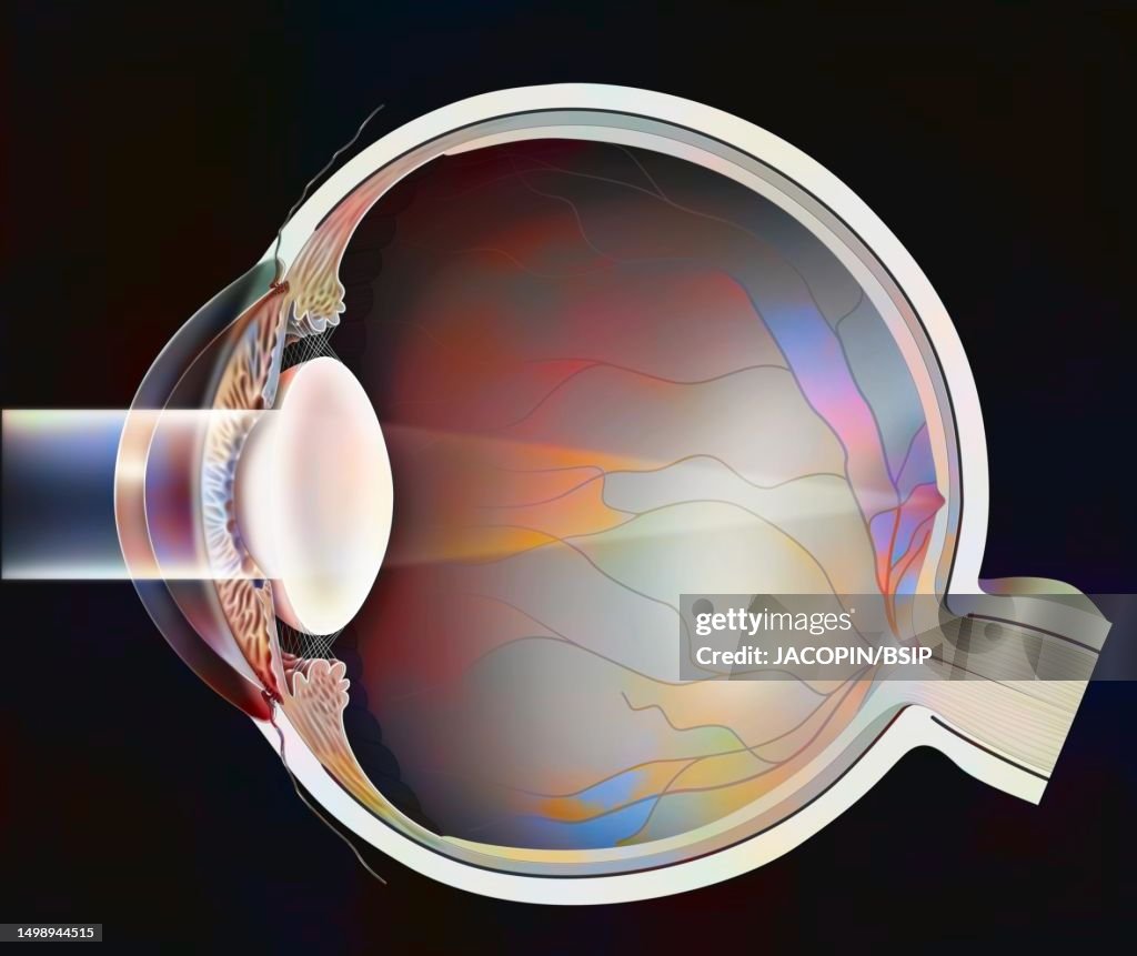 Cataract Drawing High Res Vector Graphic Getty Images