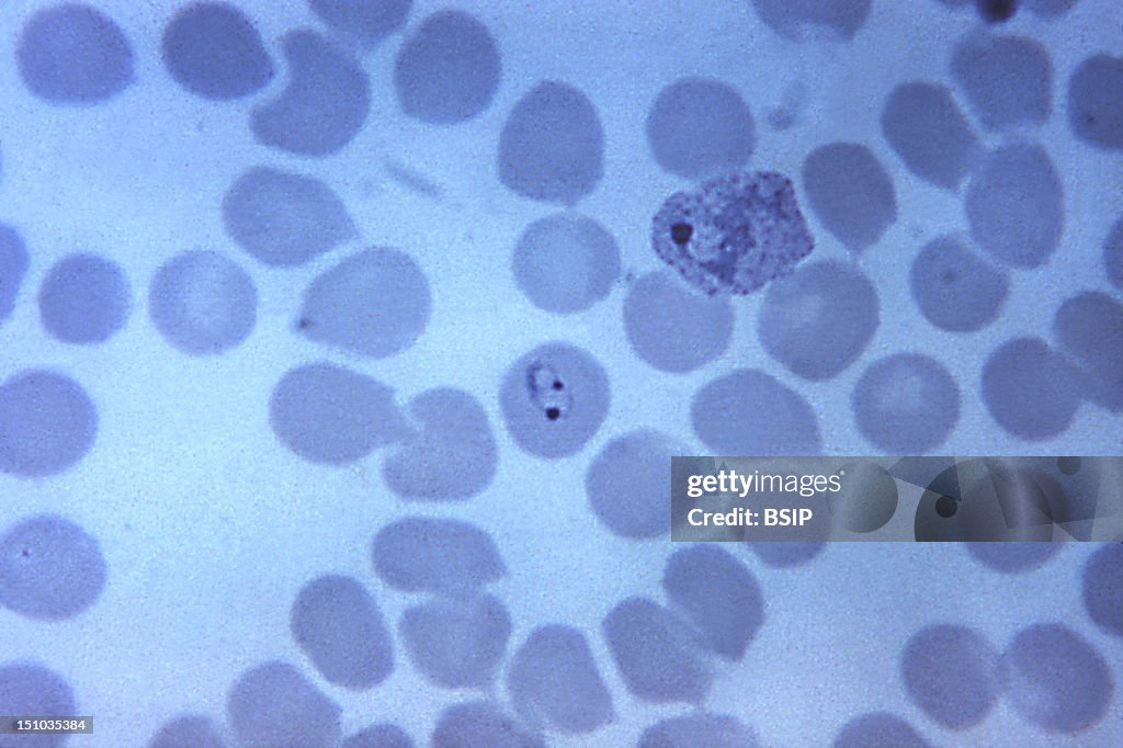 Plasmodium Vivax Under Microscope