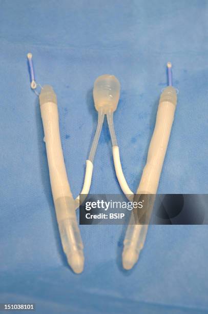 Phalloplasty Step 1 Photos And Premium High Res Pictures Getty Images