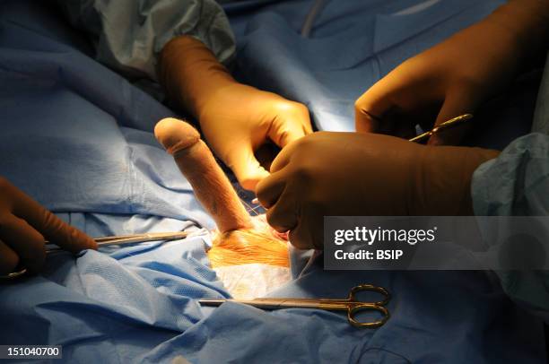 Skin Graft Surgery Photos and Premium High Res Pictures - Getty Images Skin Graft Surgery Photos and Premium High Res Pictures - Getty Images