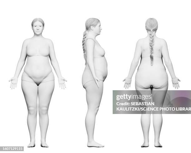 Overweight Female Body Illustration High Res Vector Graphic Getty Images