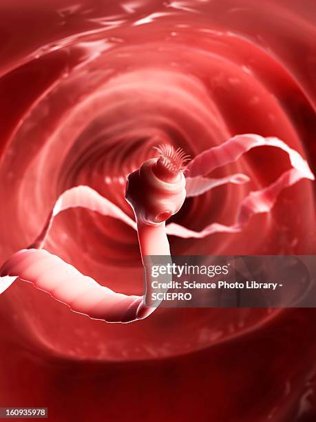 Tapeworm Photos And Premium High Res Pictures Getty Images