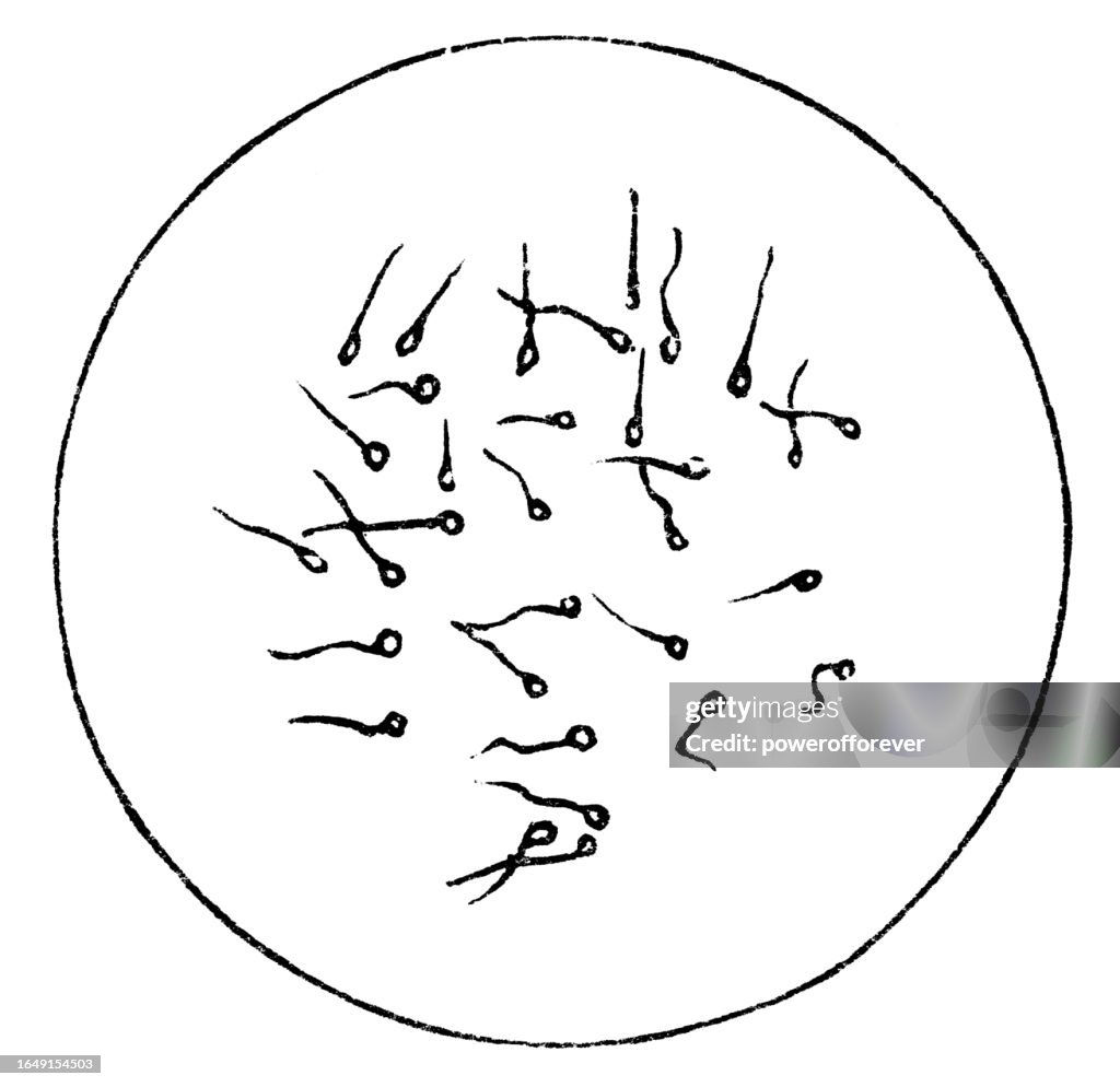 Microscopic View Of Sperm In Human Urine 19th Century High Res Vector Graphic Getty Images