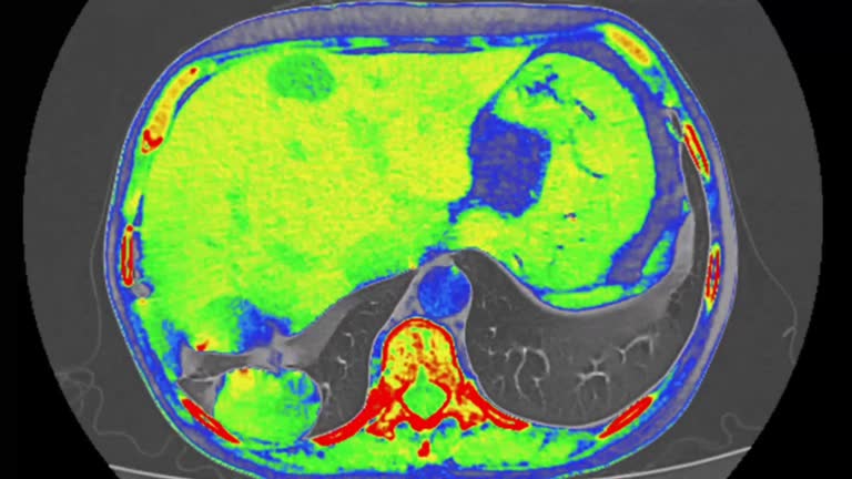 Lung Ct Scan Videos And Hd Footage Getty Images