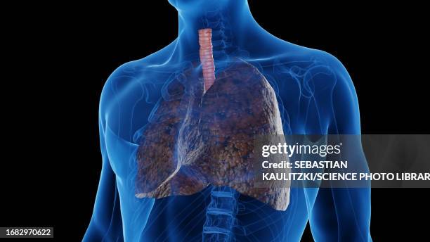 Smokers Lungs Illustration High Res Vector Graphic Getty Images