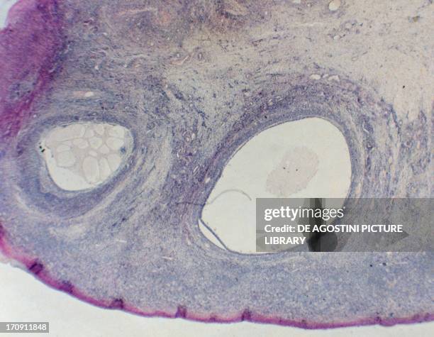 Ovary Pattern Photos And Premium High Res Pictures Getty Images