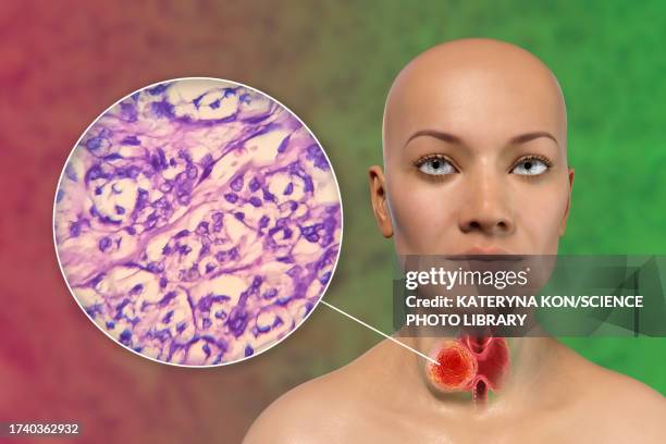 Thyroid Gland Histology Photos And Premium High Res Pictures Getty Images