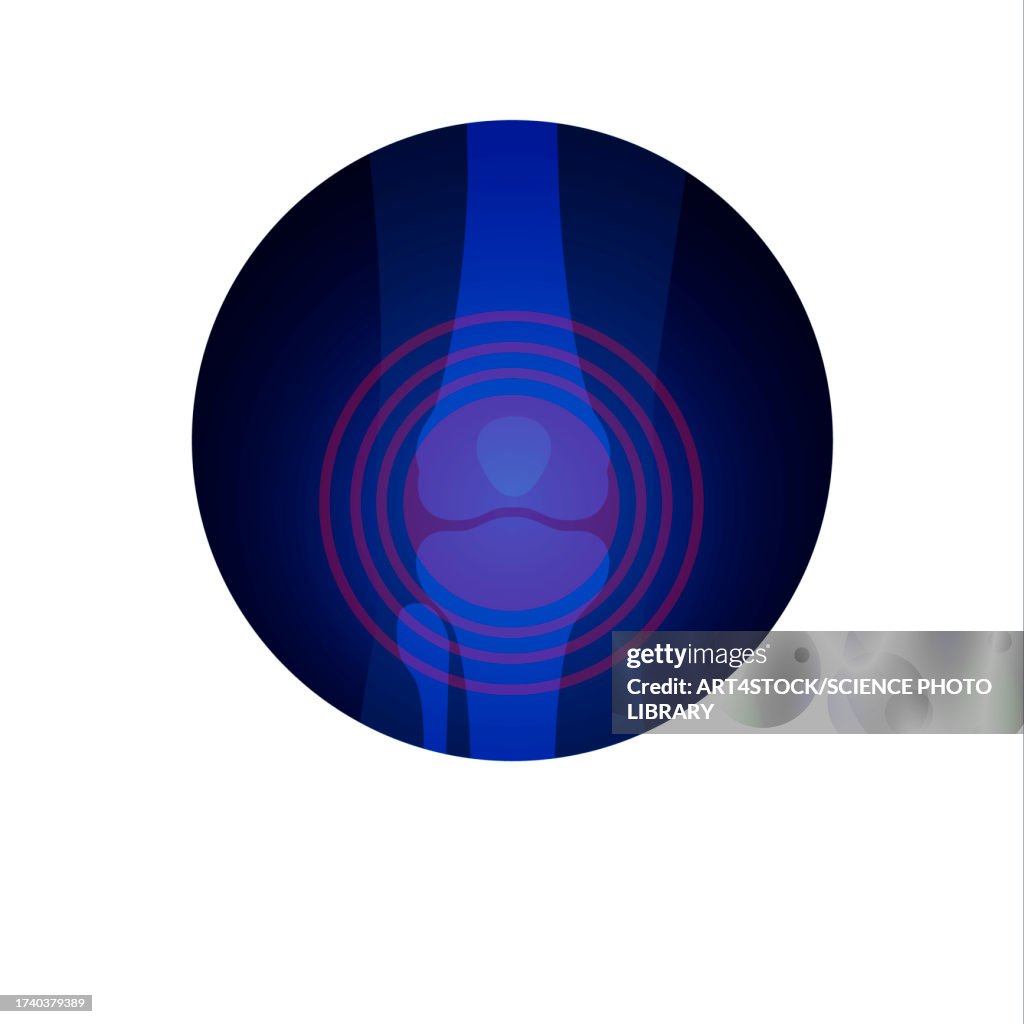 Knee Xray Conceptual Illustration High Res Vector Graphic Getty Images