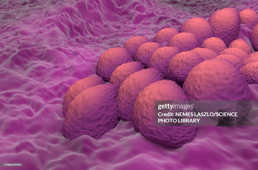 Endometrial Cancer Illustration High Res Vector Graphic Getty Images
