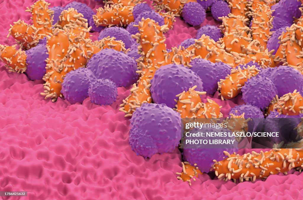 Fungal Skin Infection Illustration High Res Vector Graphic Getty Images