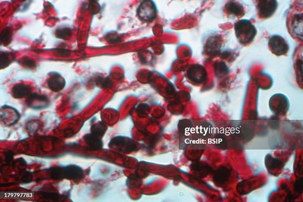 Candida Albicans Microscope Slide